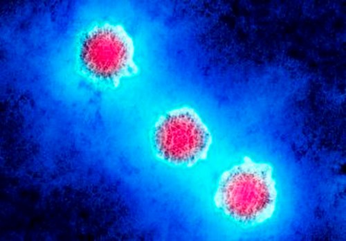 Herpes Simplex Virus 1 | Culture Collections